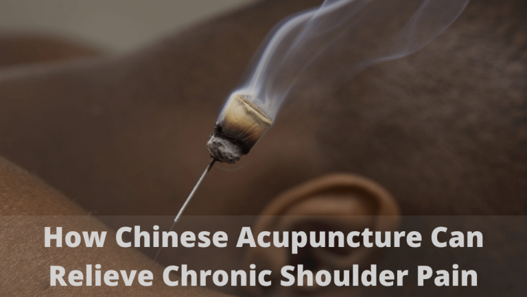 How Chinese Acupuncture Can Relieve Chronic Shoulder Pain | Acubody